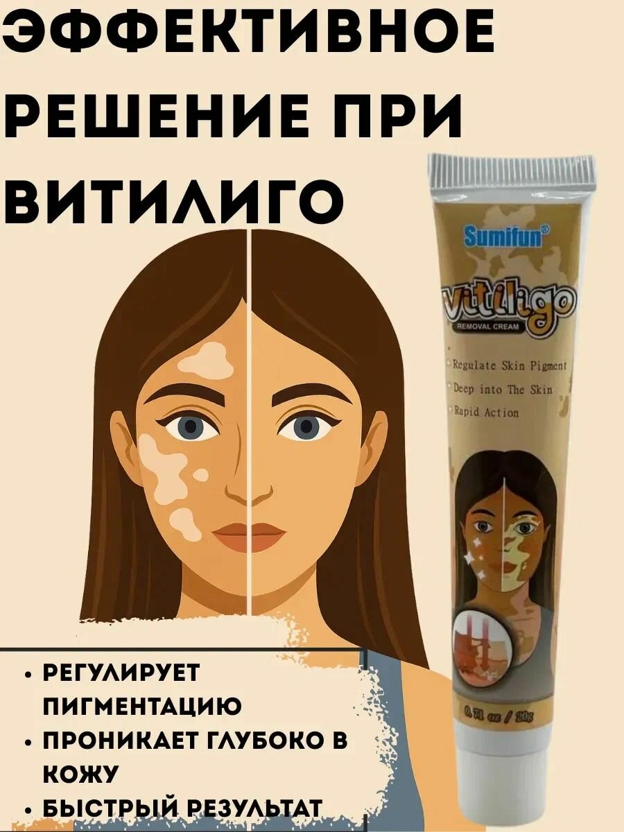 Крем от витилиго, белых пятен 20 г, для усиления пигментации при витилиго лейкодерма, лишай, бурые пятна