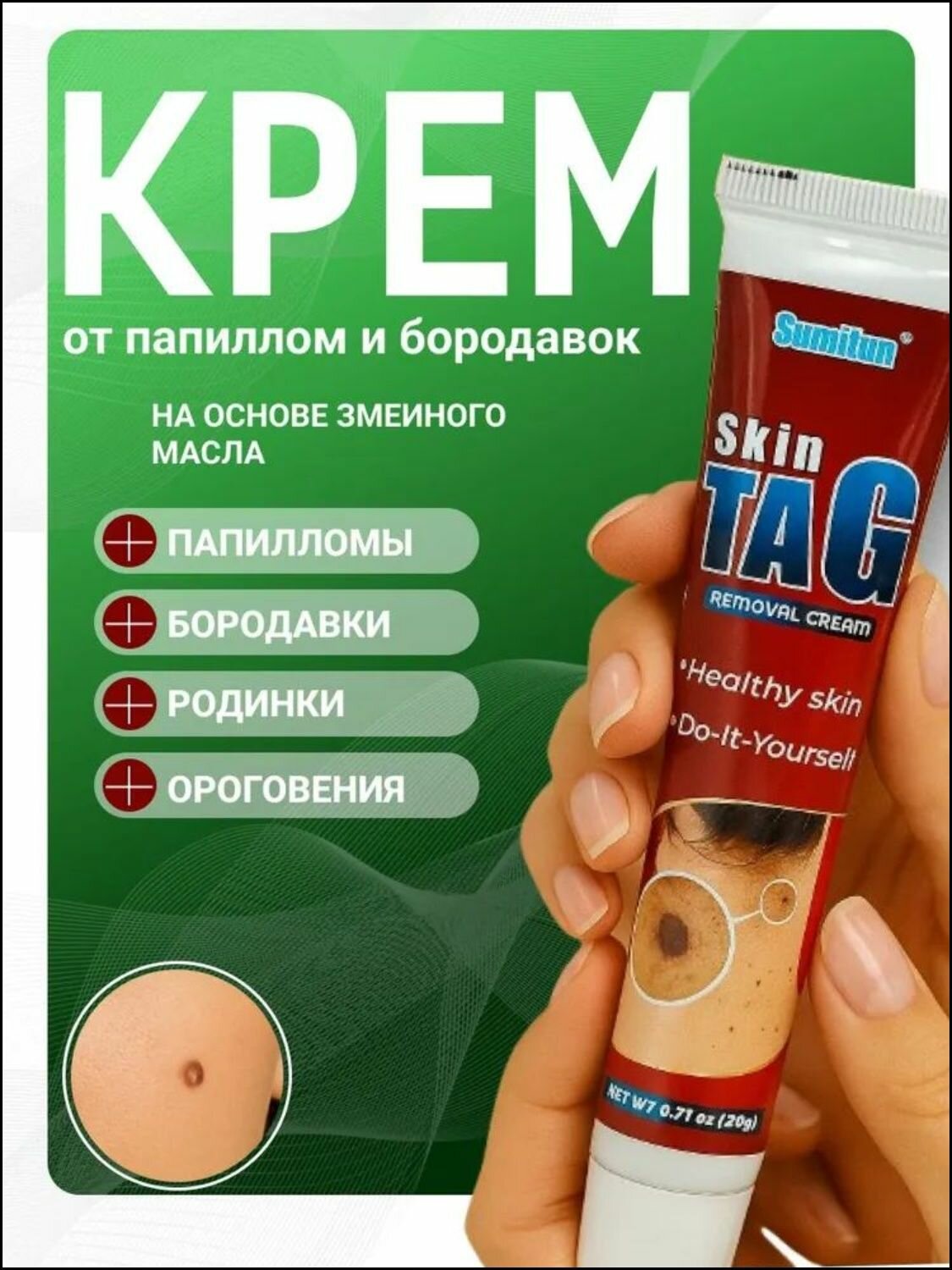 Крем средство от папиллом и бородавок / Средство гель от прыщей 20 мл. Крем для тела, рук, ног. Антипапиллом