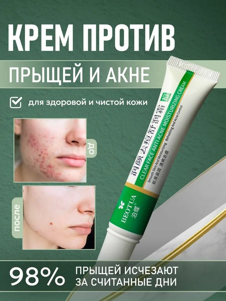 Крем от прыщей и акне точечного действия, средство для проблемной кожи