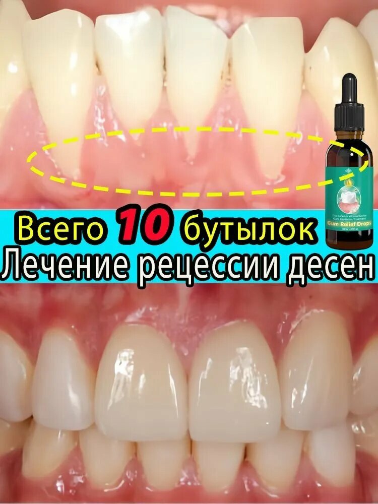 Используется для лечения пародонтита, стоматита, снятия чувствительности и отека десен, восстановления, профилактики и укрепления поврежденных десен, 150 мл