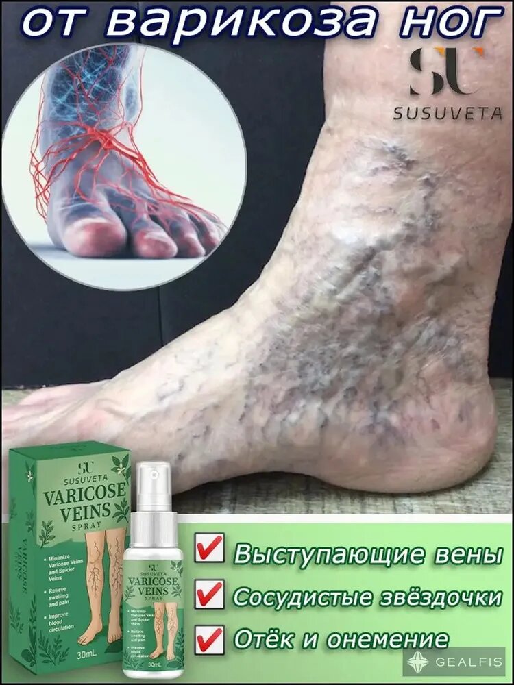 Крем-гель для ног при варикозе, от тяжести и усталости в ногах, помогает уменьшить отёчность и сосудистые звёздочки, тонизирующий охлаждающий уход, 30мл