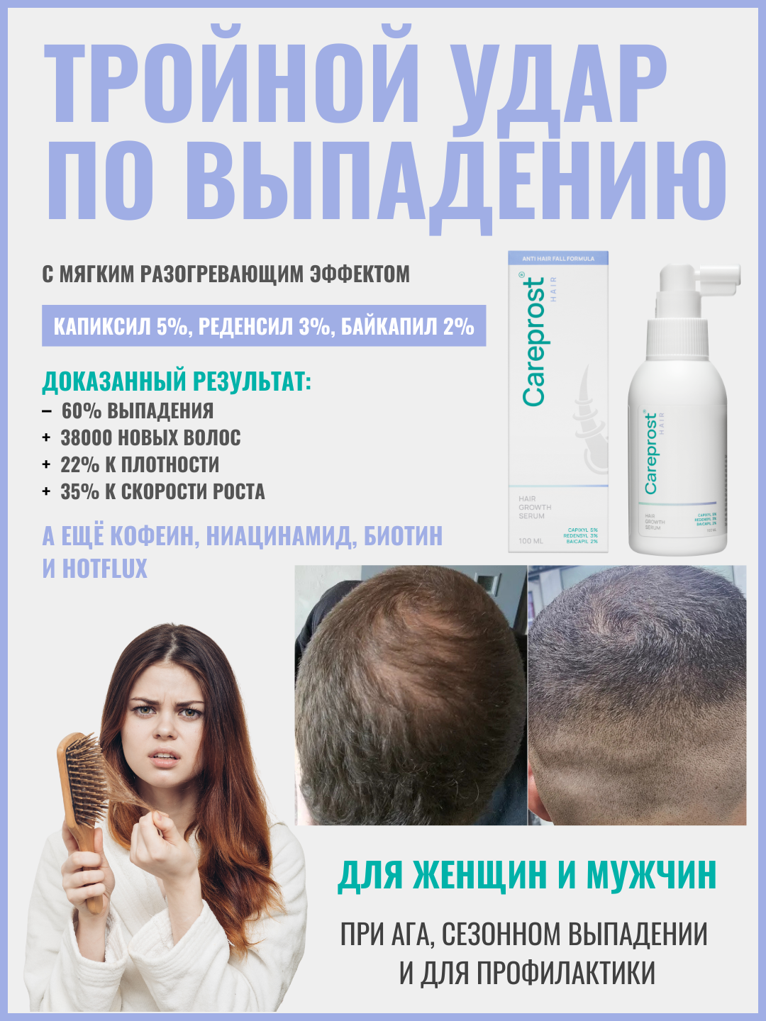 Сыворотка для роста волос Careprost (Карепрост), Капиксил 5%, Реденсил 3%, Байкапил 2%