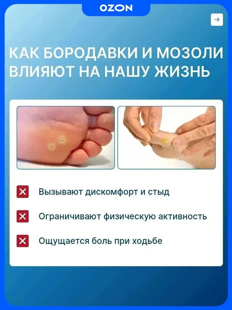 Пластырь от мозолей, стержневых натоптышей и бородавок 20 г Китайский чудо мазь