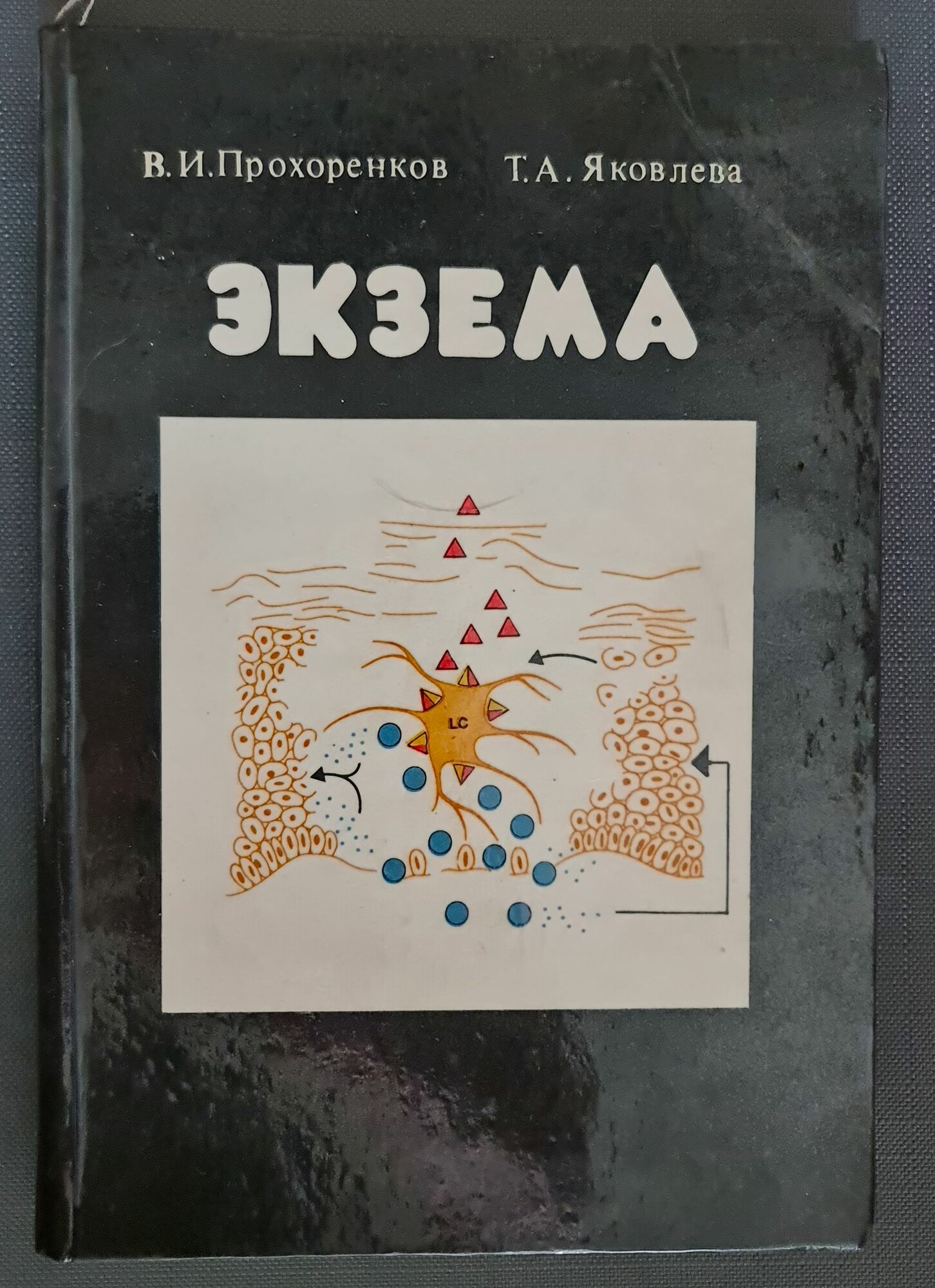 Прохоренков В, Яковлева Т. - Экзема, медицина, дерматология, редкая книга, Красноярск, 1994