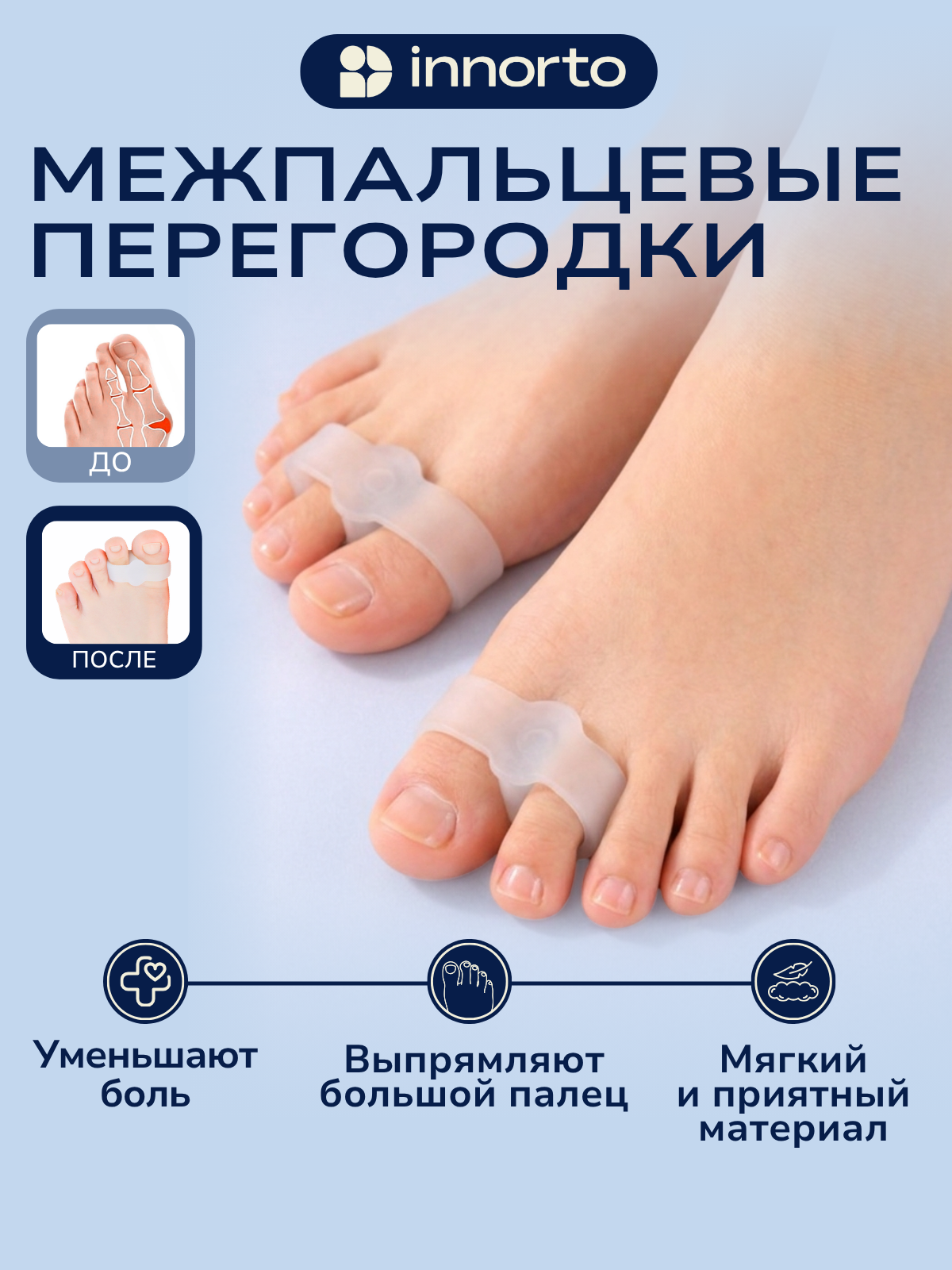 Разделители «INNORTO», артикул 45518, типоразмер универсальный - 1 пара