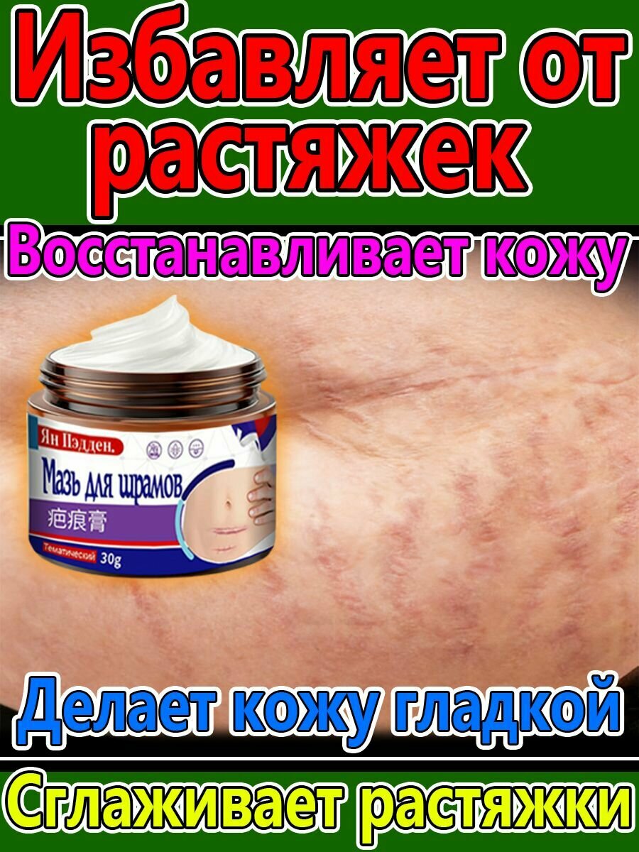 Крем от стрий роста