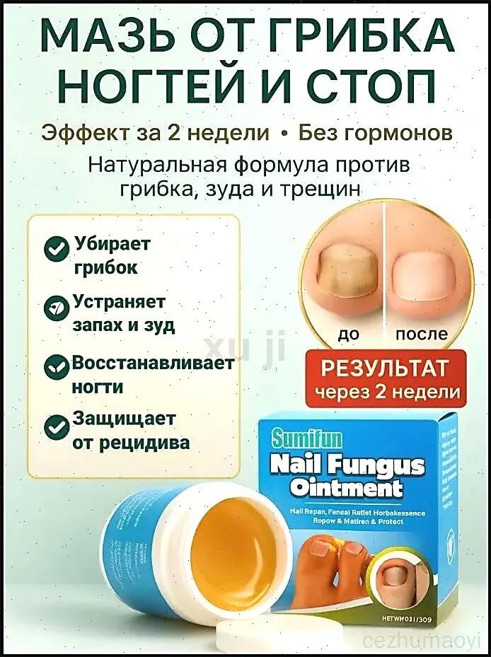 Мазь от грибка ногтей / Крем для эффективной борьбы с несовершенствами / Чудо средство для ухода за ногами против онихолизиса