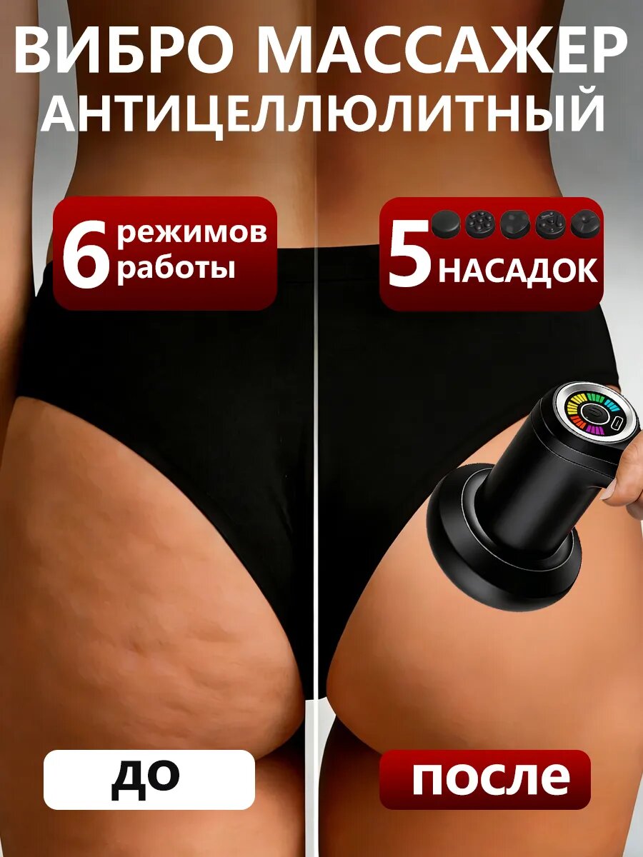 Массажер для тела и спины антицеллюлитный для похудения