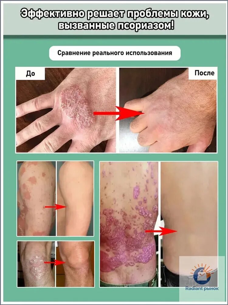 Твердое мыло — фото 1