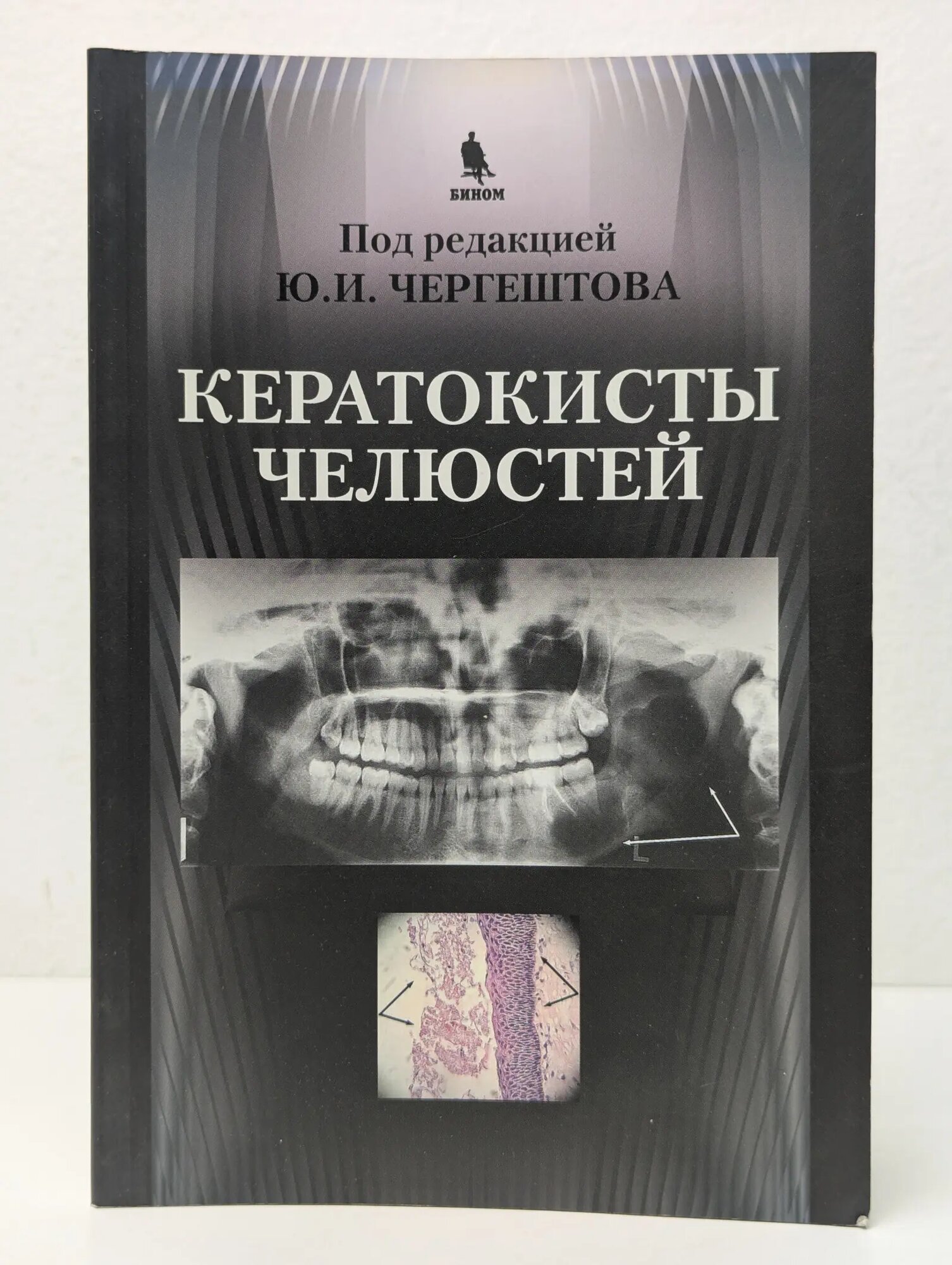 Кератокисты челюстей Чергештов Юрий Иосифович (ред.) 2011