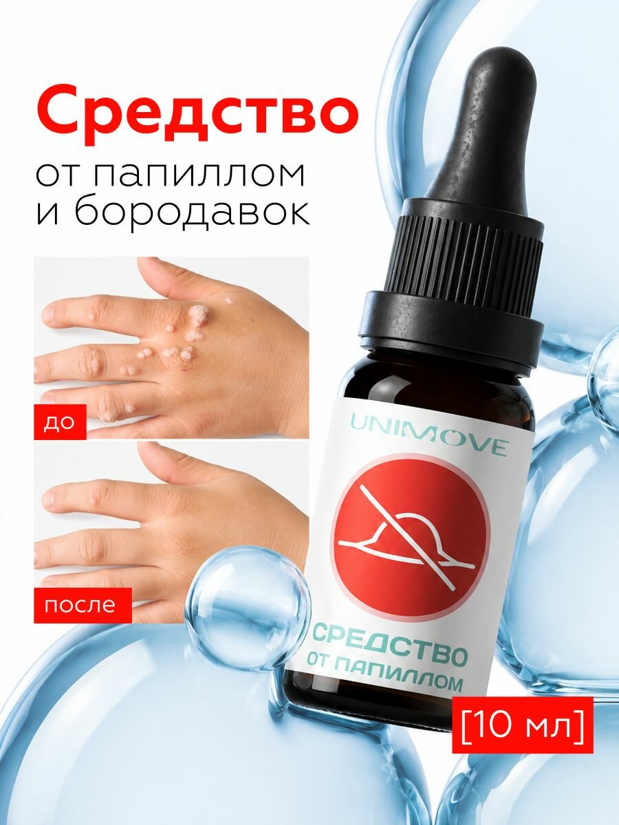 Чистотел от папиллом и бородавок, гель от папиллом, от натоптышей, от мозолей, Unimove