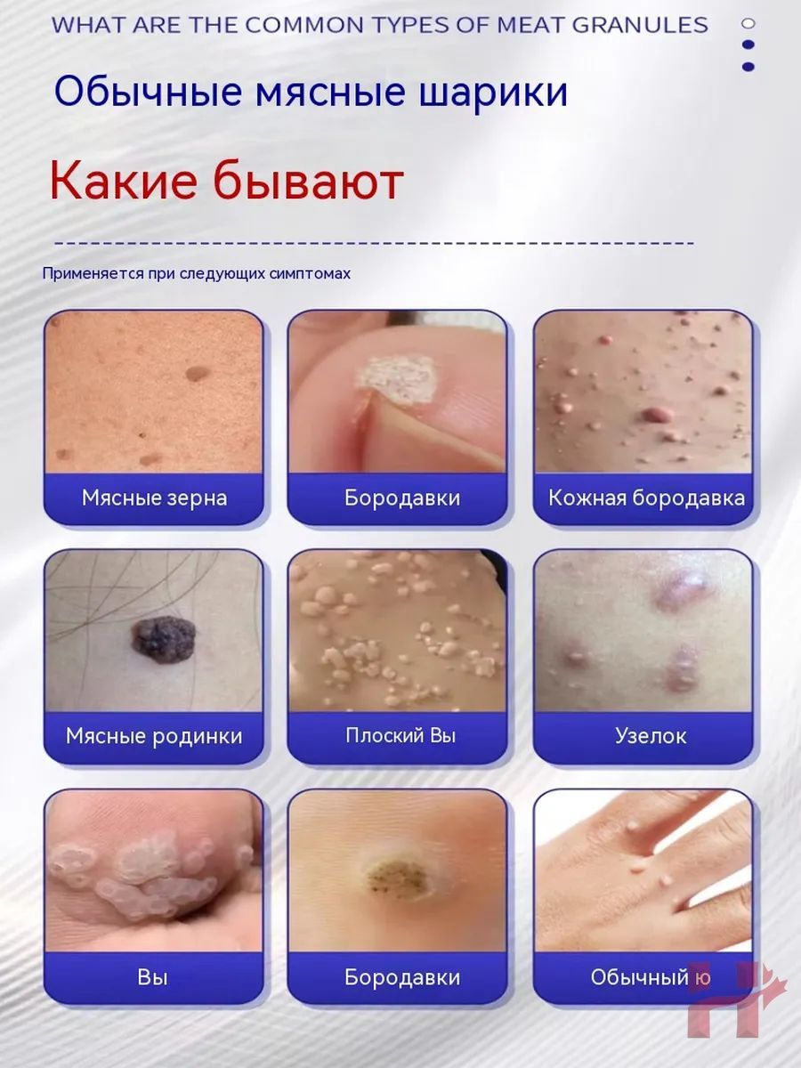 Твердое мыло — фото 1
