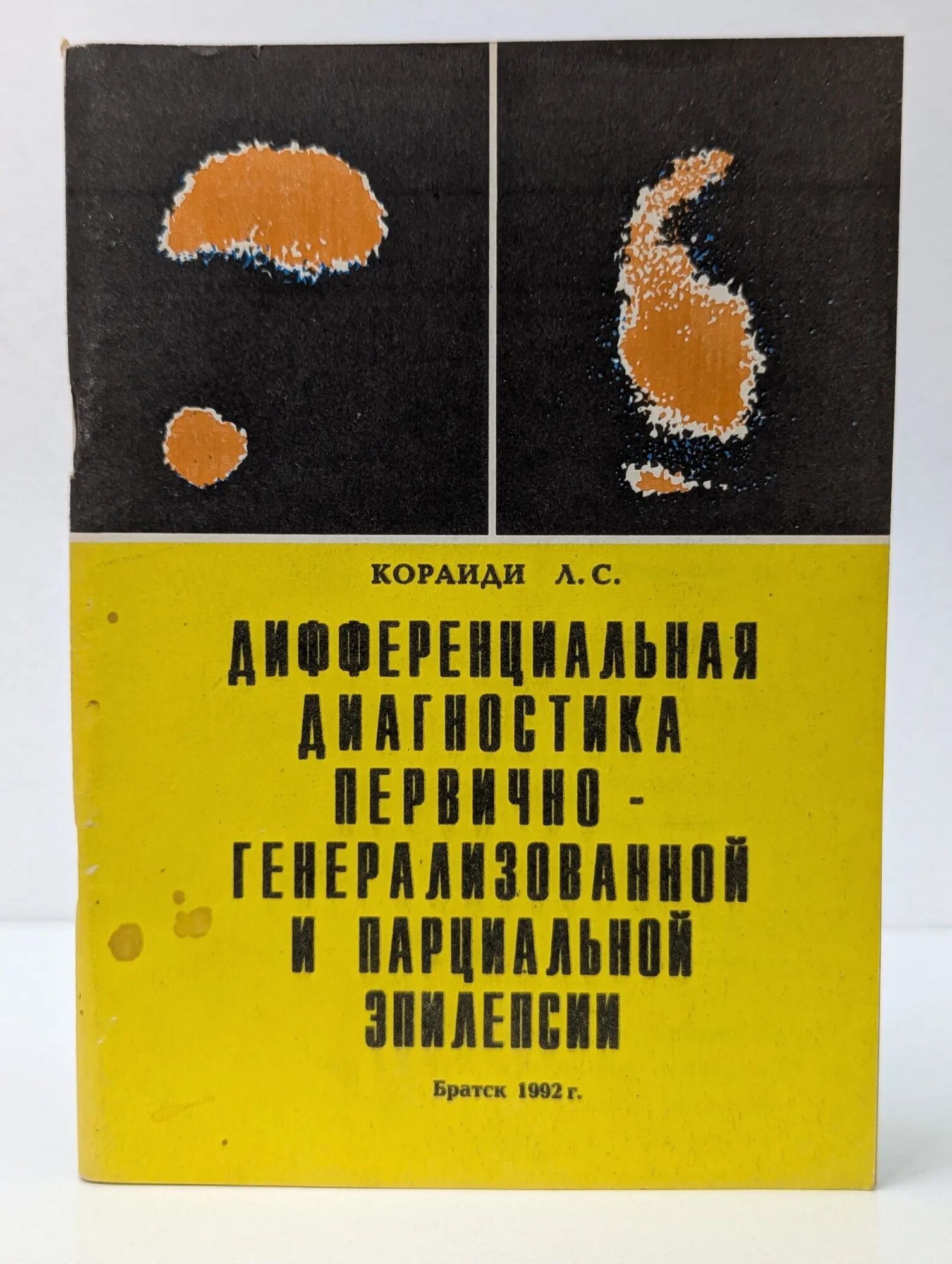 Дифференциальная диагностика первично-генерализованной и парциальной эпилепсии Кораиди Леонид Ставрович 1992