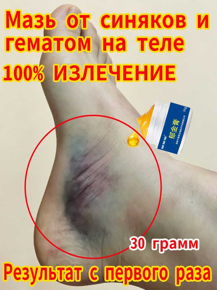Крем-бальзам от синяков и ушибов, от ушибов, гематом, отеков рассасывающий, активные компоненты способствуют уменьшению отёчности и рассасыванию синяка, китайская чудо мазь.