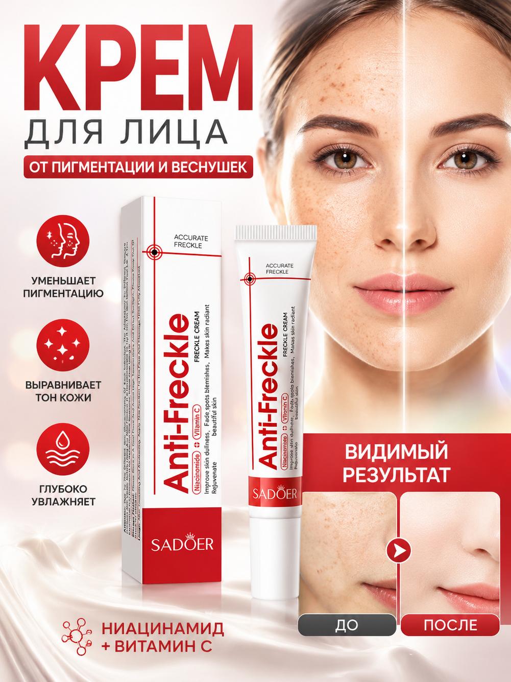 SADOER Отбеливание Крем дневной для лица SPF 20, против веснушек и пигментных пятен в коробке, 20 мл