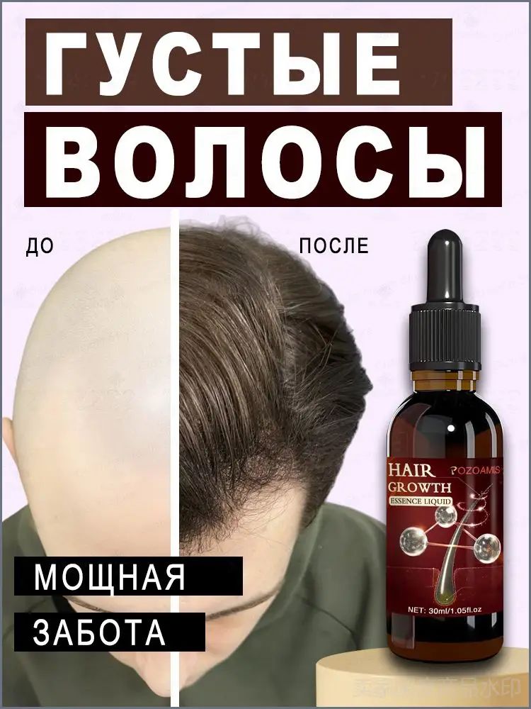 POZOAMIS-18O Лосьон для волос, 90 мл