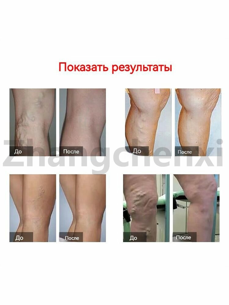 Гетры для ног — фото 1