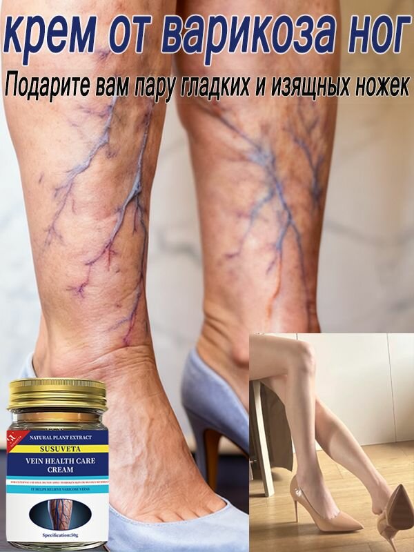 Мазь от варикоза, крем от венозных сеточек при тромбофлебите, венотоник от отеков и тяжести в ногах, Эффективен при лечении варикозного расширения вен, тромбоз , для улучшения кровообращения, 50г