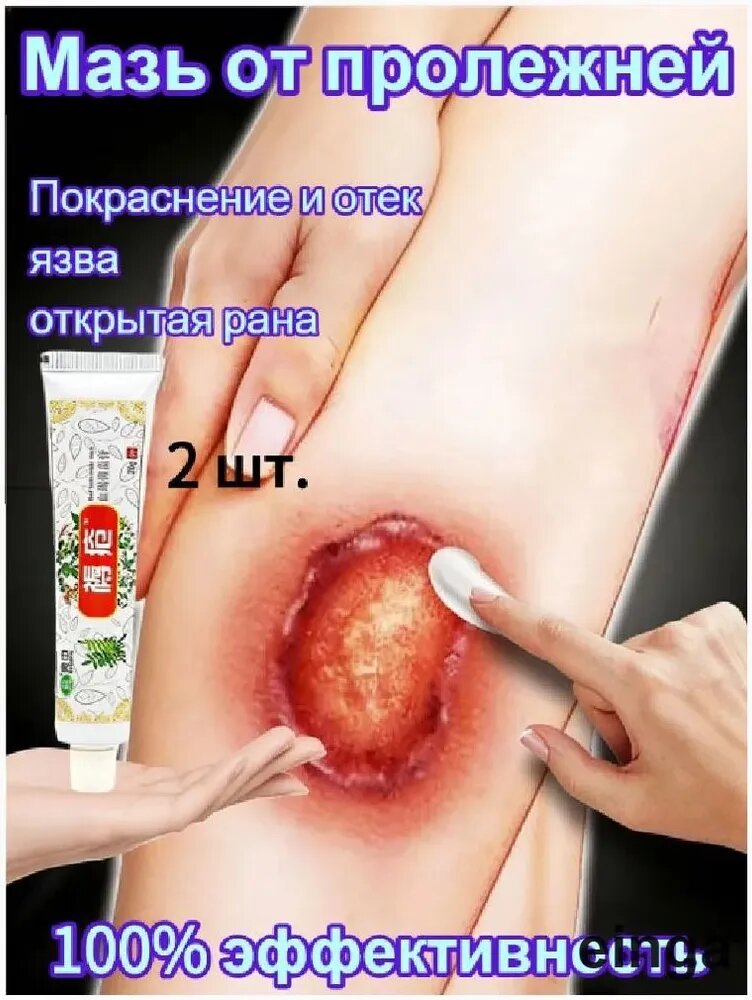 Мазь от пролежней регенерирующая 40г, при покраснениях, язвах и открытых ранах, Быстрое заживление для лежачих больных, после операций и у пожилых.