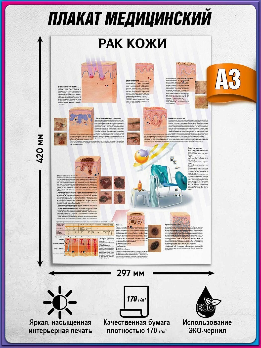 Информационный медицинский плакат "Рак кожи" / Формат А3 (30х42 см.)