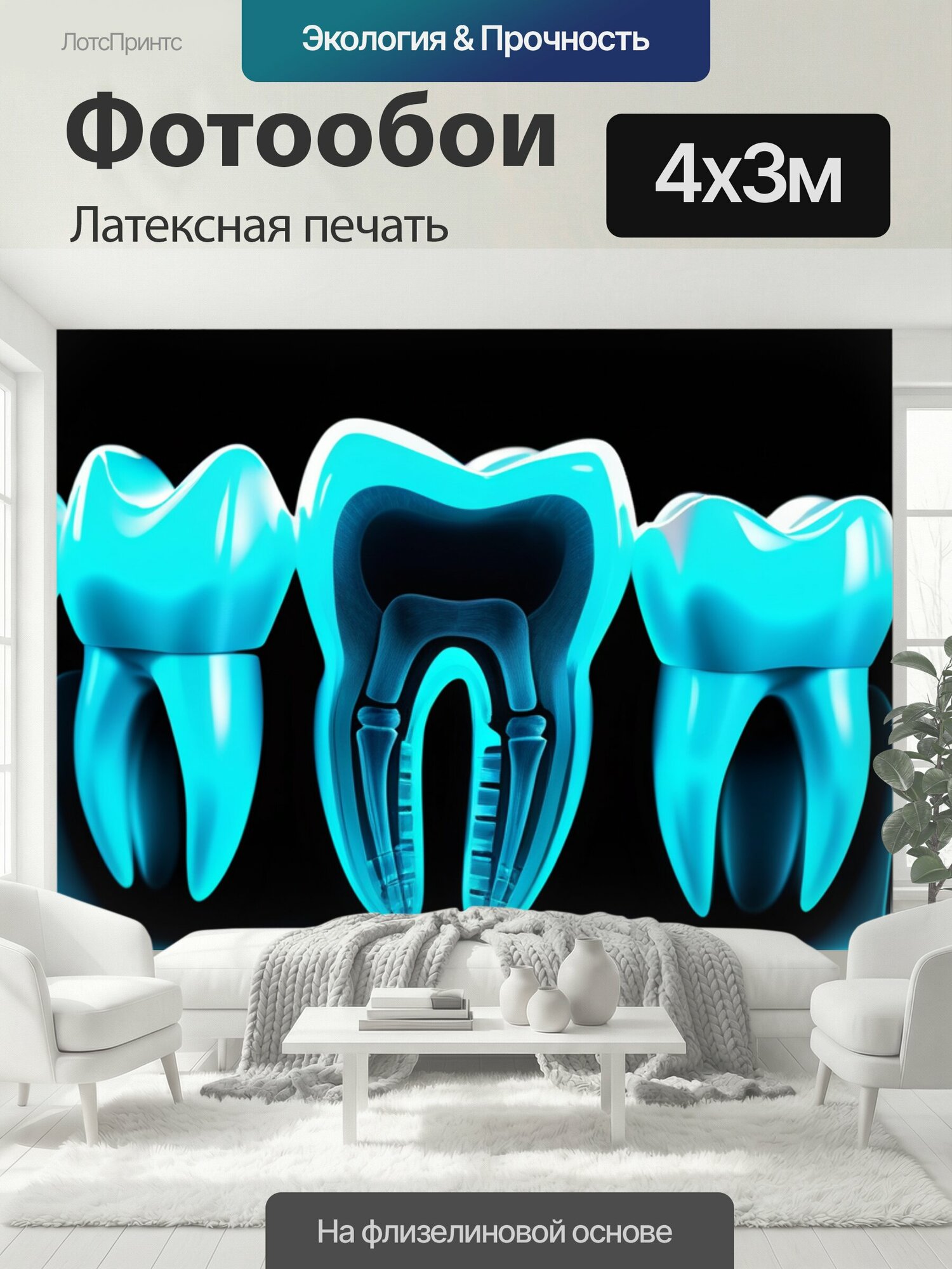 Фотообои моющиеся ударопрочные "Стоматологический рентген зубов" 400x300 см. латексная печать