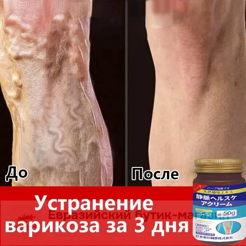 Мазь от варикоза 50 г Быстрое облегчение боли и отёков