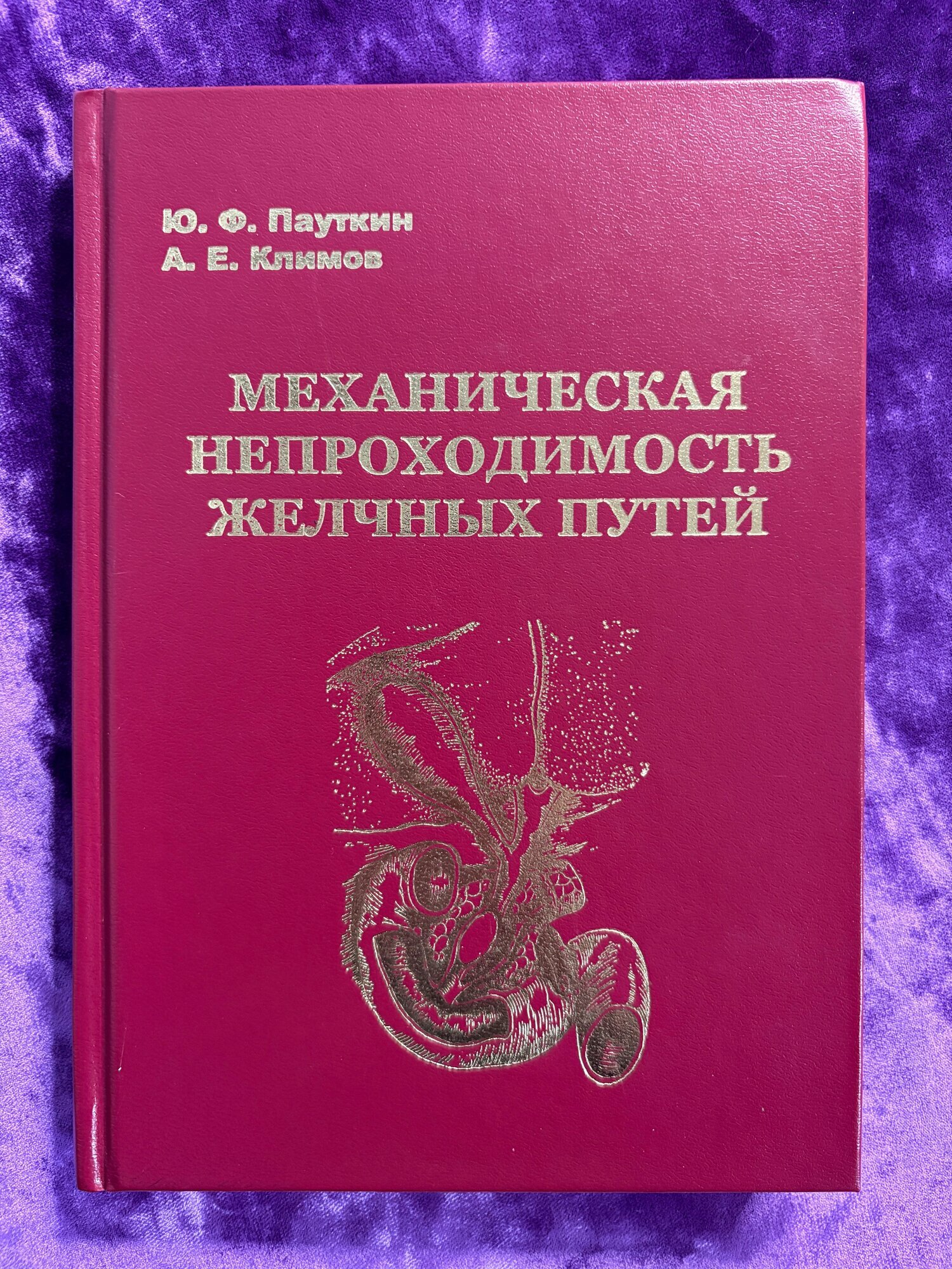 Механическая непроходимость желчных путей