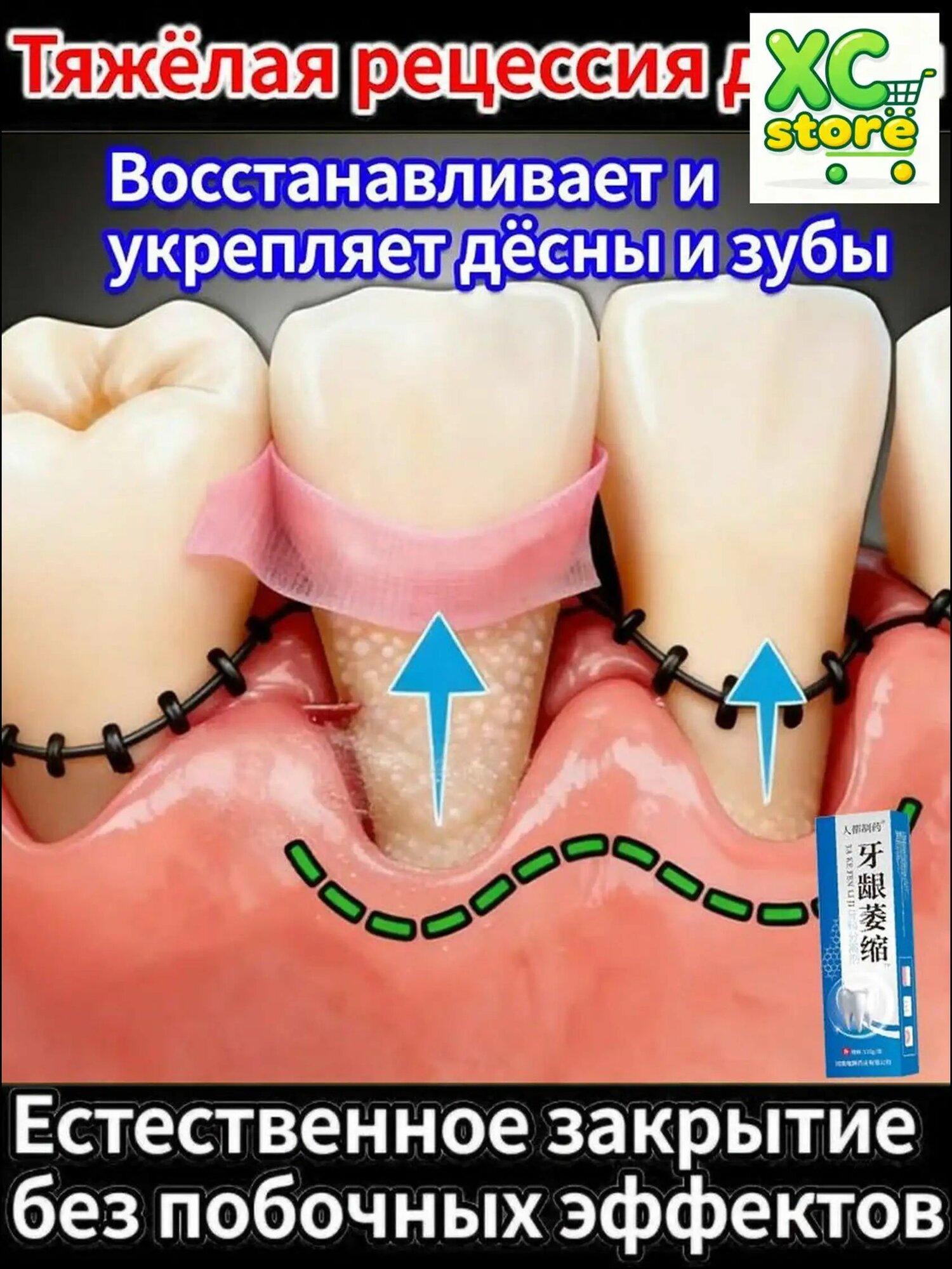 Эксклюзивный гель 120 мл для комплексного ухода обеспечивает эффективную защиту зубов и десен, способствуя предотвращению атрофии, устранению кровоточивости и снижению риска разрывов тканей.