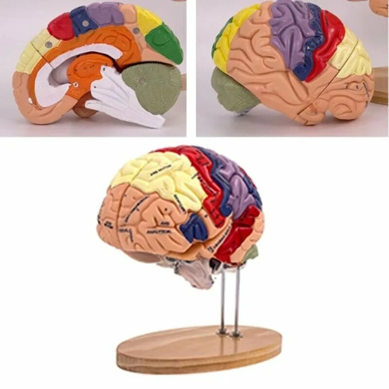 Четырехкомпонентная модель мозговой артерии, прикрепленной к головному мозгу с 2-кратным увеличением (магнитное поглощение)