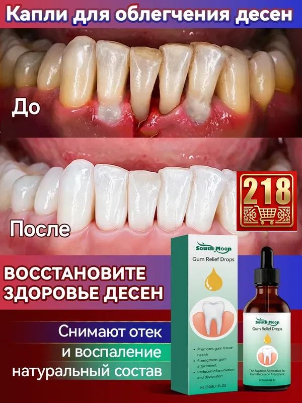 Используется для лечения пародонтита, стоматита, снятия чувствительности и отека десен, восстановления, профилактики и укрепления поврежденных десен, Гигиена полости рта.30 мл.