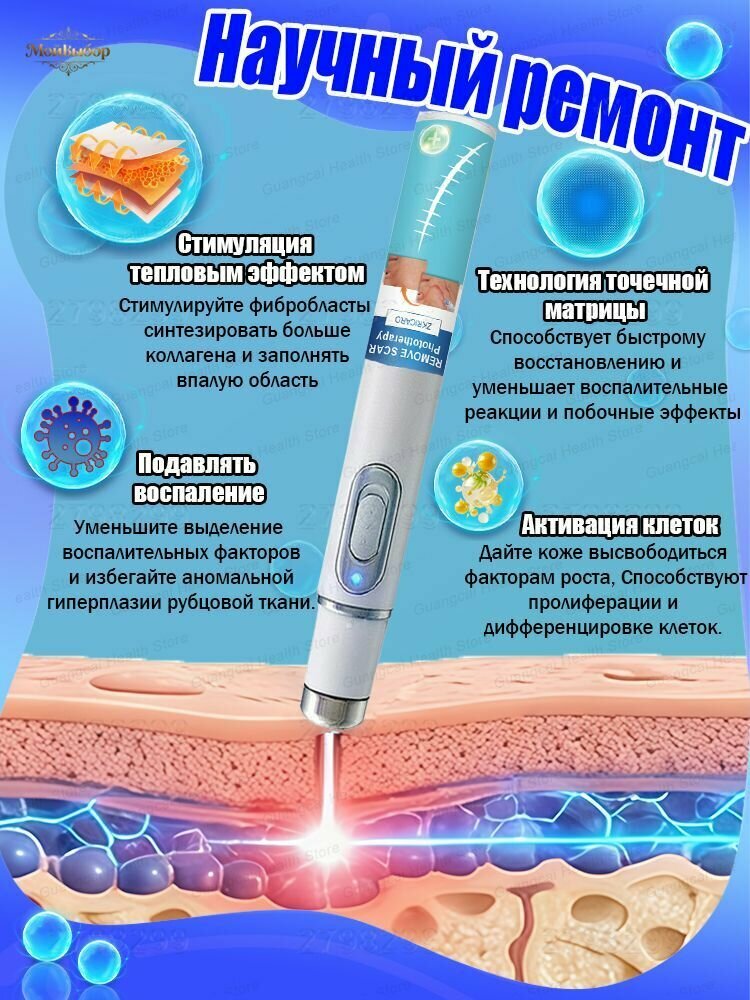 Лазерный аппарат для удаления рубцов. Быстро удаляет гипертрофические , послеоперационные рубцы и после родов, осветляет пигментацию рубцов и делает кожу гладкой. одна лазерная ручка