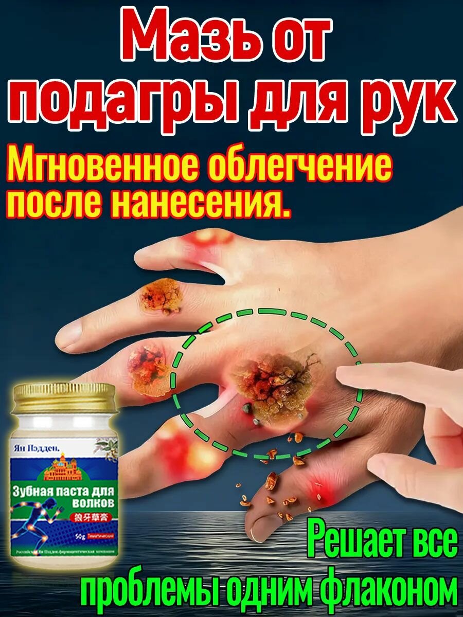 Мазь от подагры, Устранение боли при артрите, коленях, пальцах ног и т. д, на ноге и для рук и артрита 50 г