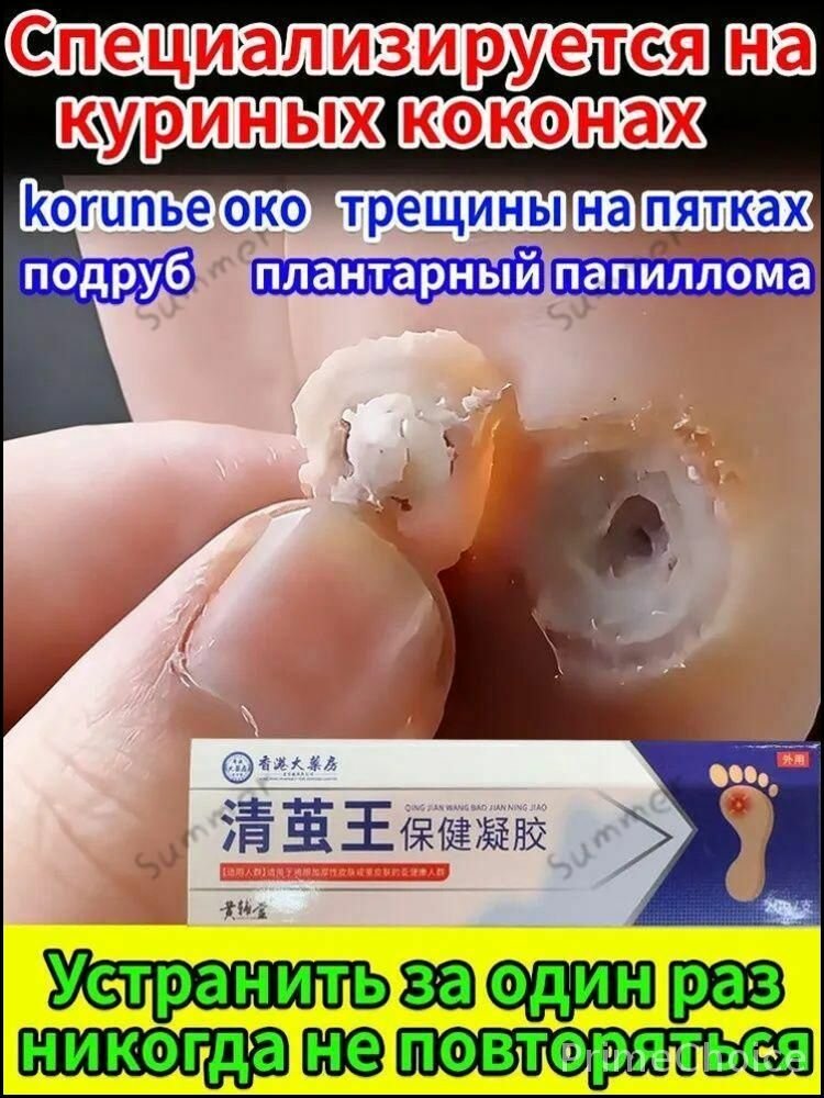 Пластырь для удаления мозолей Крем от сухих мозолей стержневых, бородавок, натоптышей, шипиц и пяточных шпор