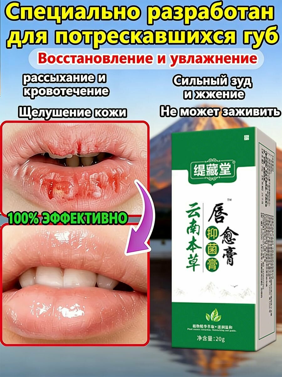 Гель для ухода за губами от герпеса, трещин и воспаления, безопасный состав, снимает зуд и жжение, 20 г