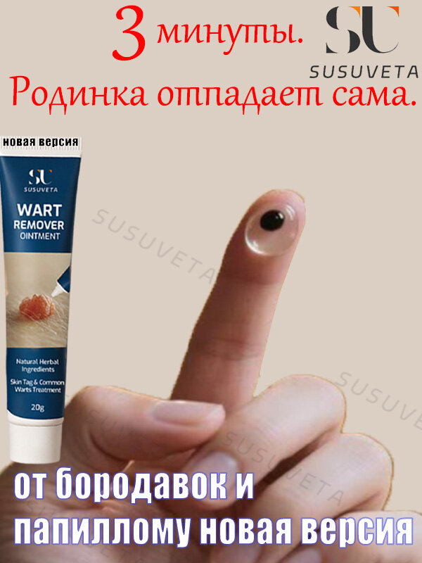SUSUVETA / Средство от папиллом, Мазь от бородавок и папиллом на руках и лице без побочных эффектов.20 грамм