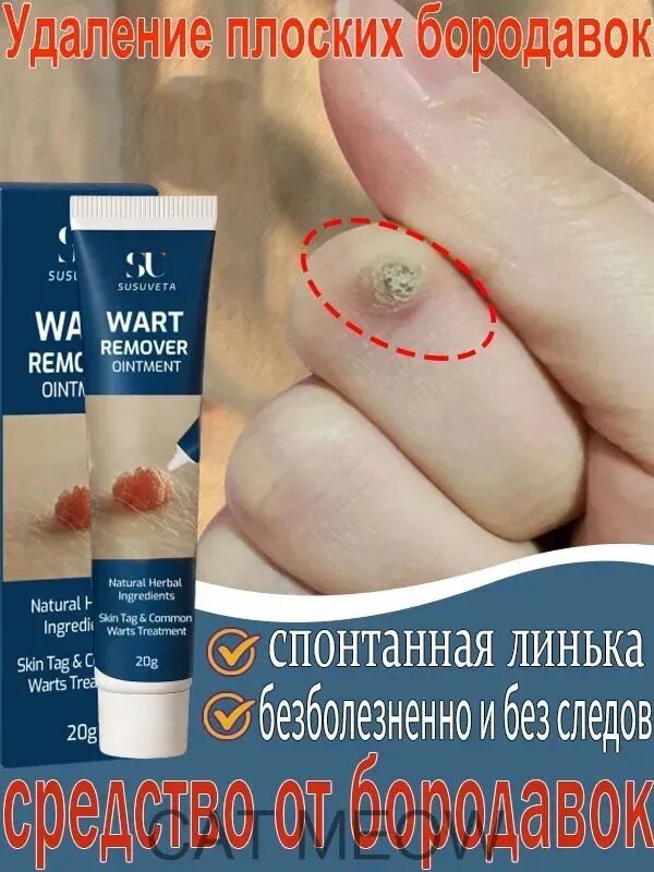 Средство от папиллом и бородавок(Совершенно новая версия ), для удаления бородавок папиллом, сухих мозолей на ногах и теле, мазь для ухода за кожей, безболезненно, не оставляет следов 20 г