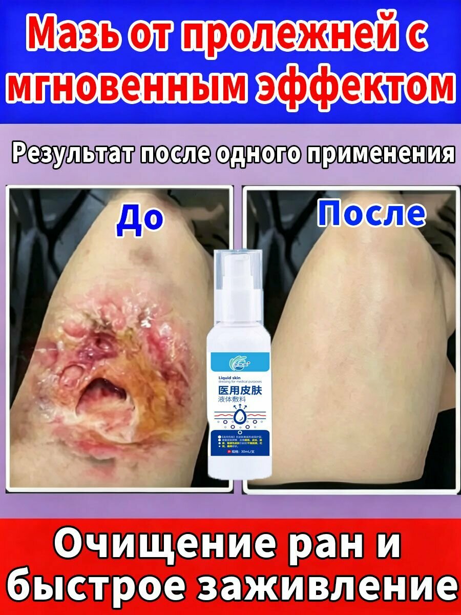 Мазь от пролежней 30г, для ран и ожогов, Крем против пролежней и от опрелостей ранозаживляющий для лежачих больных, Средствами по уходу за больными