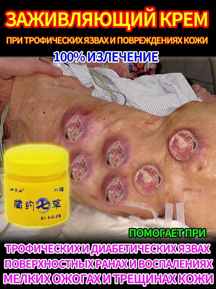 Крем для ухода за диабетической стопой питающий и заживляющий с мочевиной от сухости ран трещин при диабете