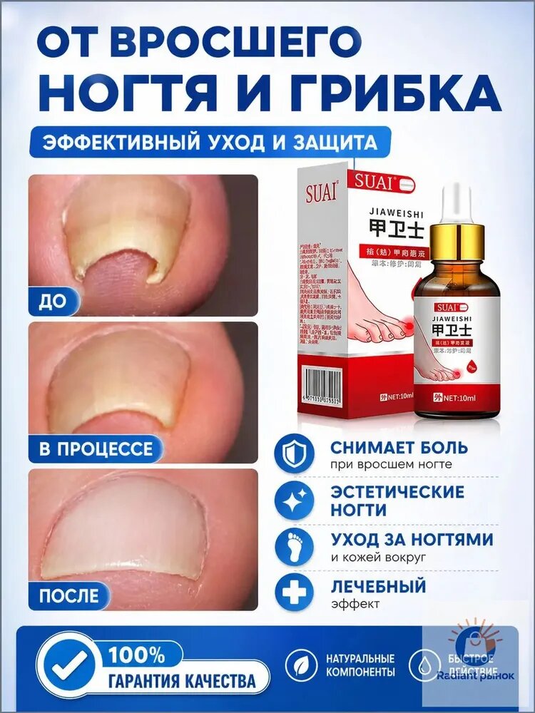 Премиумэмульсия для кутикулы против врастания ногтя, восстанавливающая огрубевшую дерму стоп, 10 мл