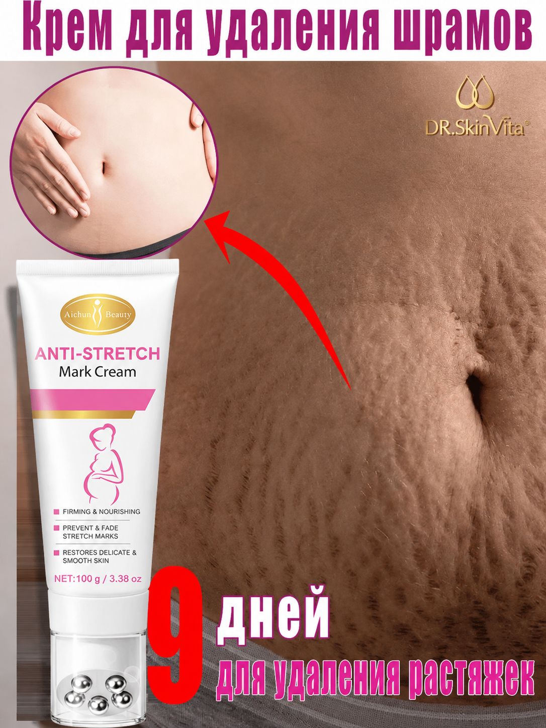 DR.SKINVITA Крем от растяжек для подростков / Подтягивающий крем (после родов, для беременных), 100 г. Убирает стрии, устраняет сухость и дряблость кожи, разглаживает неровности