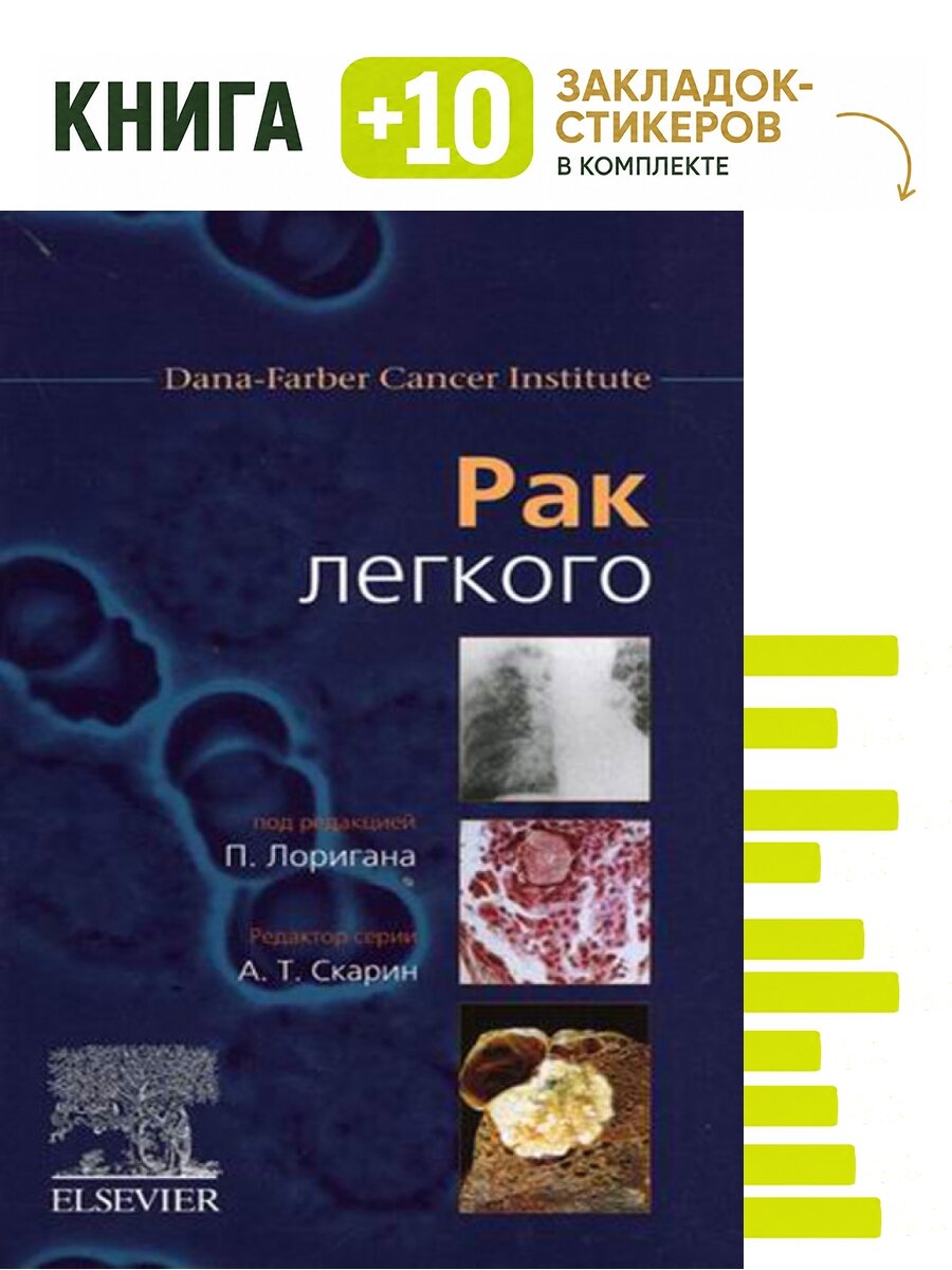 Рак легкого. Комплект: книга + 10 закладок-стикеров