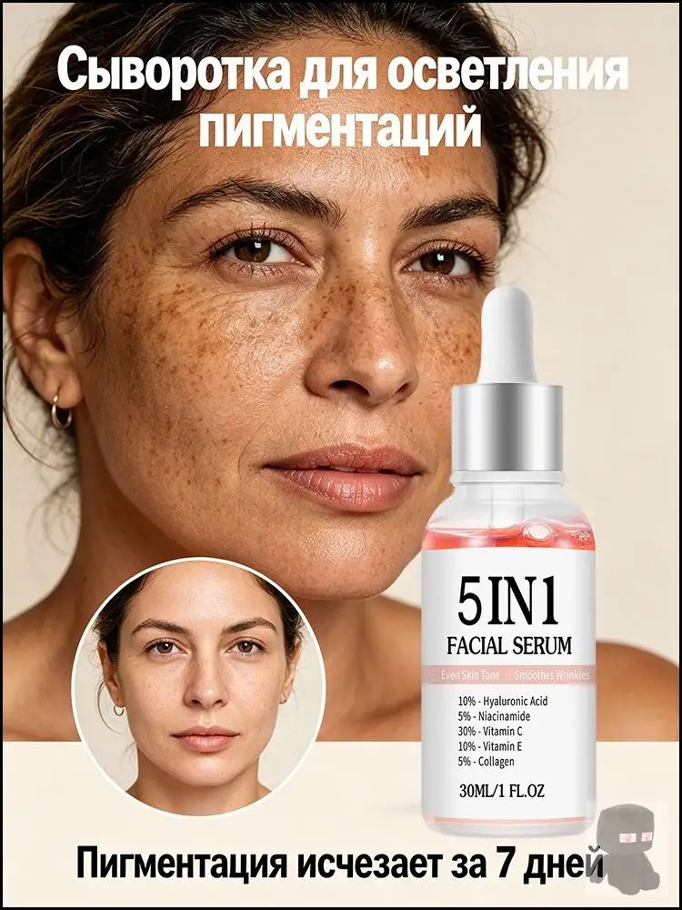 Сыворотка для борьбы с пигментные и пятнами, для ухода за кожей при возрастных пятнах, веснушках и пигментации, для лица и рук, 30 мл