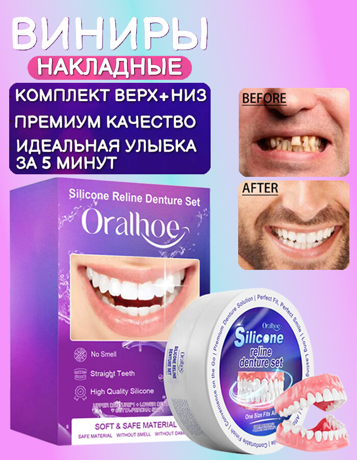 Crazylife Накладные виниры для зубов, Включая Верхние И Нижние Зубы