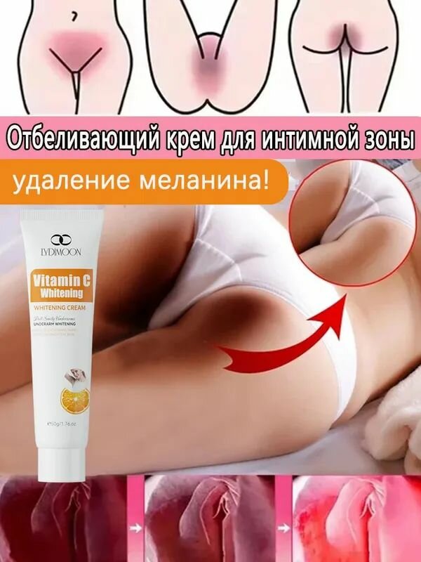 Отбеливающий крем для интимной зоны Корея, против пигментации, с витамином C, для тела, ягодиц, бикини, подмышек, коленей и локтей удаление меланина, без раздражения 50 г