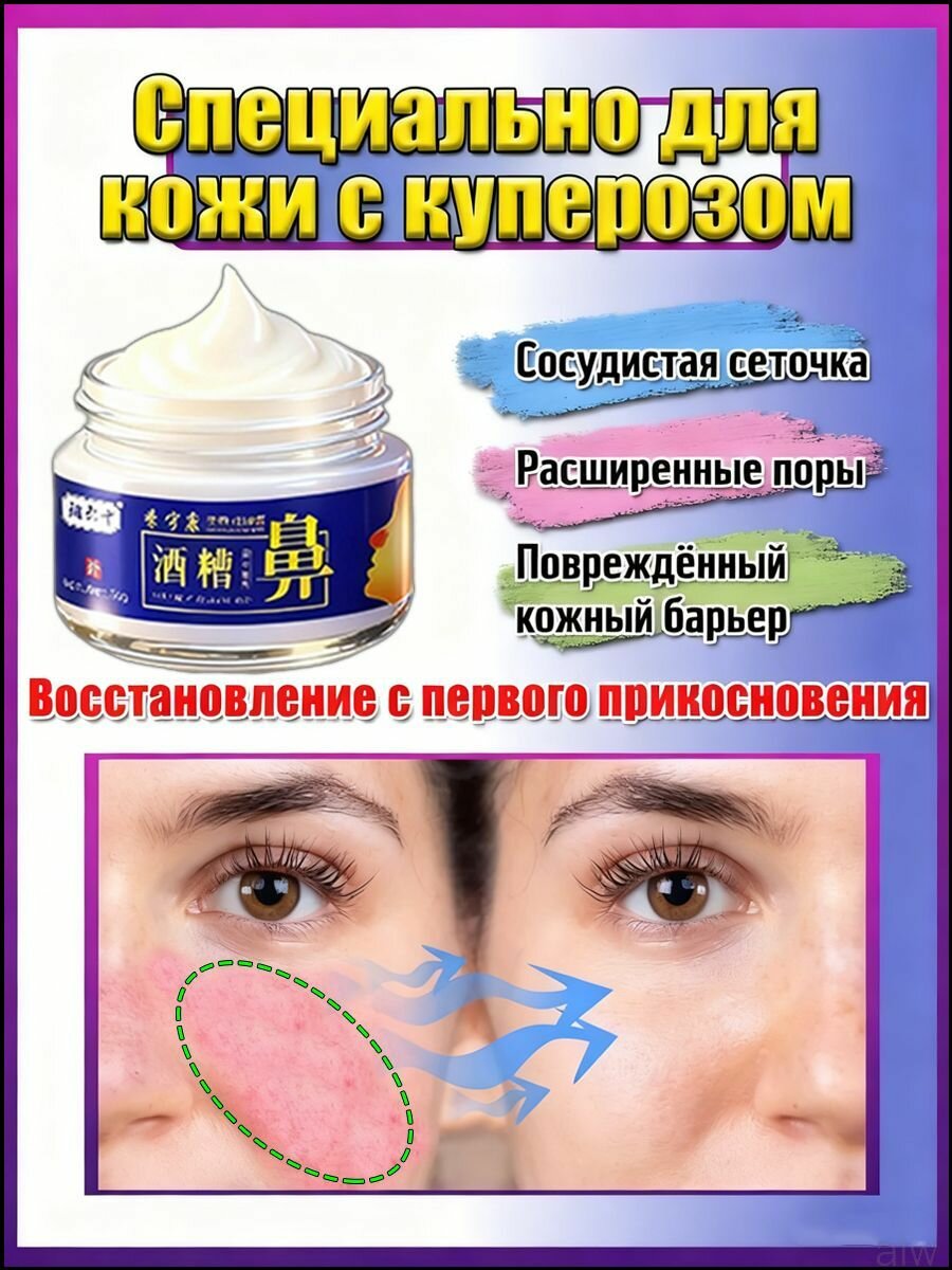 Мазь от Китайский розацеа на лице купероза и покраснений
