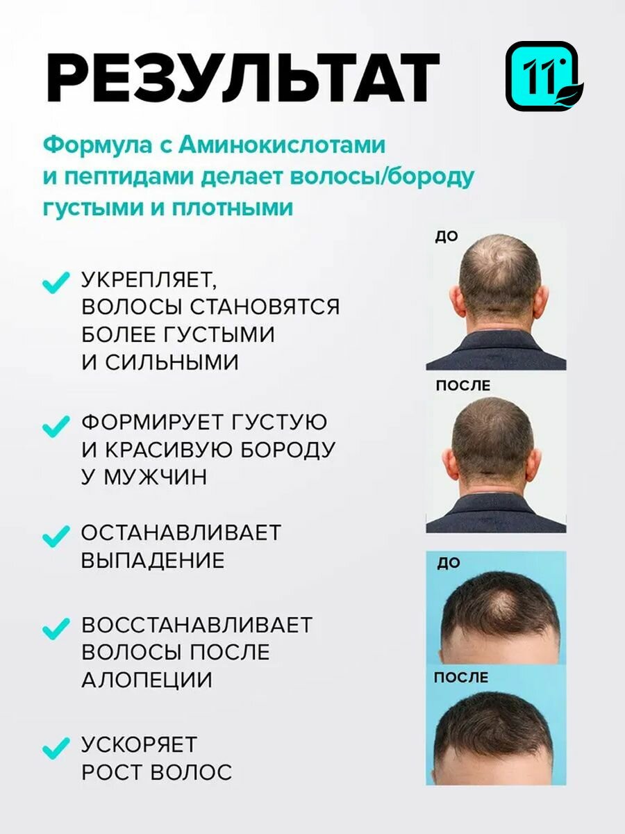 Лосьон для роста волос, бороды и усов. Сыворотка Капиксил 27% средство уход за волосами, не минаксидилл. - 60 мл.