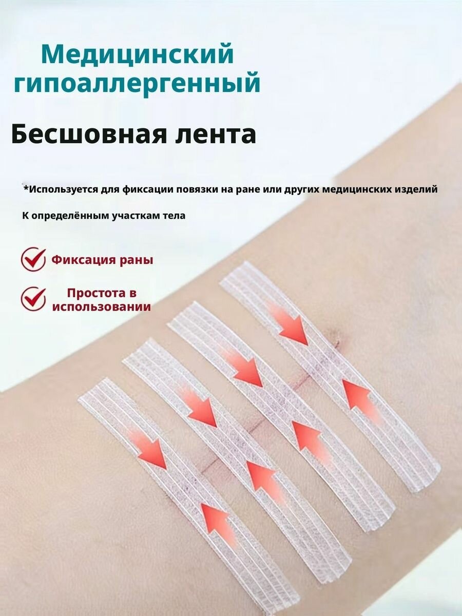 Пластыри для скрепления краев раны без наложения швов 6х100 мм, 15 полосок