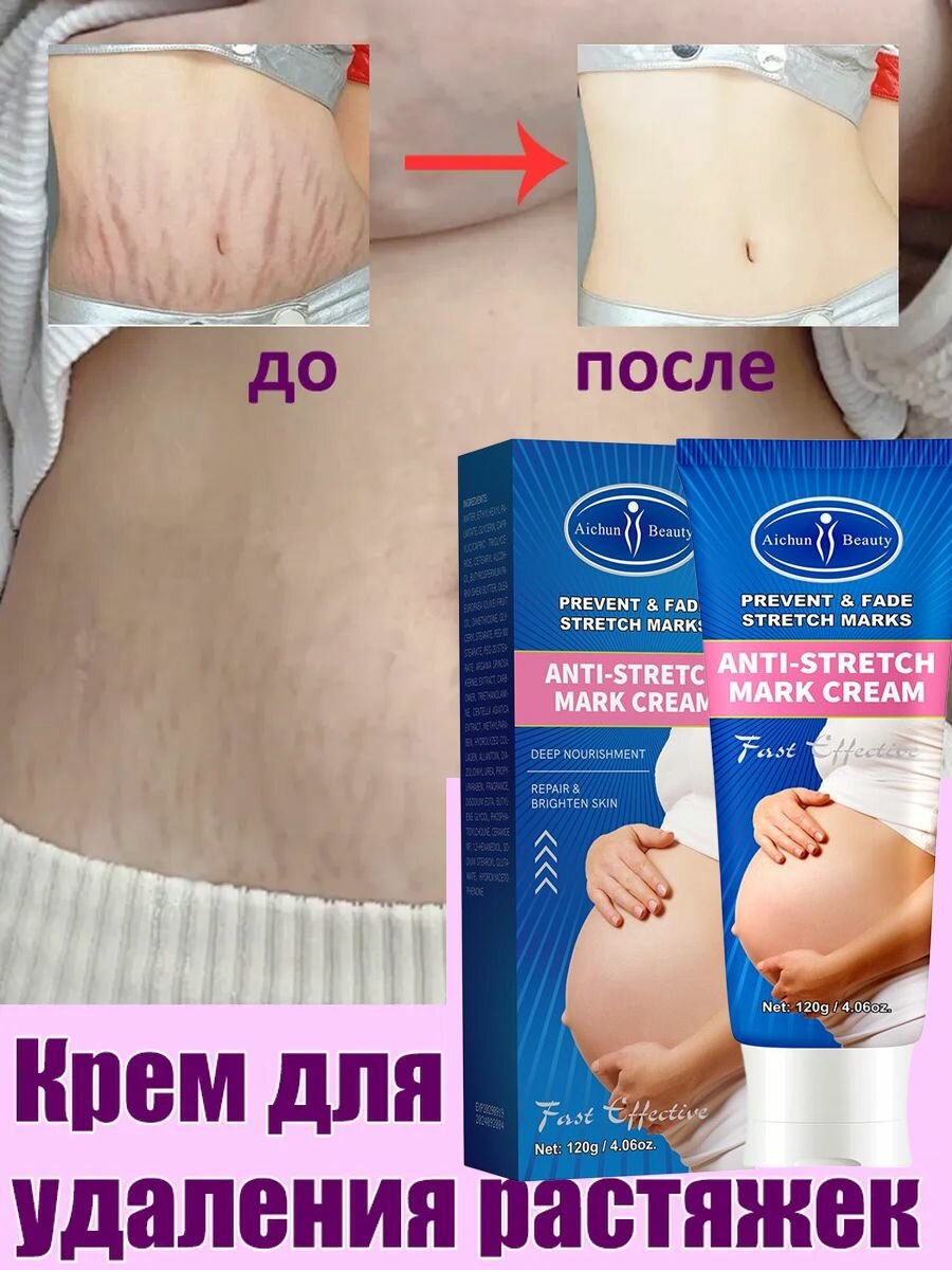 Крем от растяжек для беременных, для тела, груди, ягодиц, живота росле родов, увлажняет и питает кожу, восстанавливает эластичность кожи, безопасен и не вызывает раздражения 120г