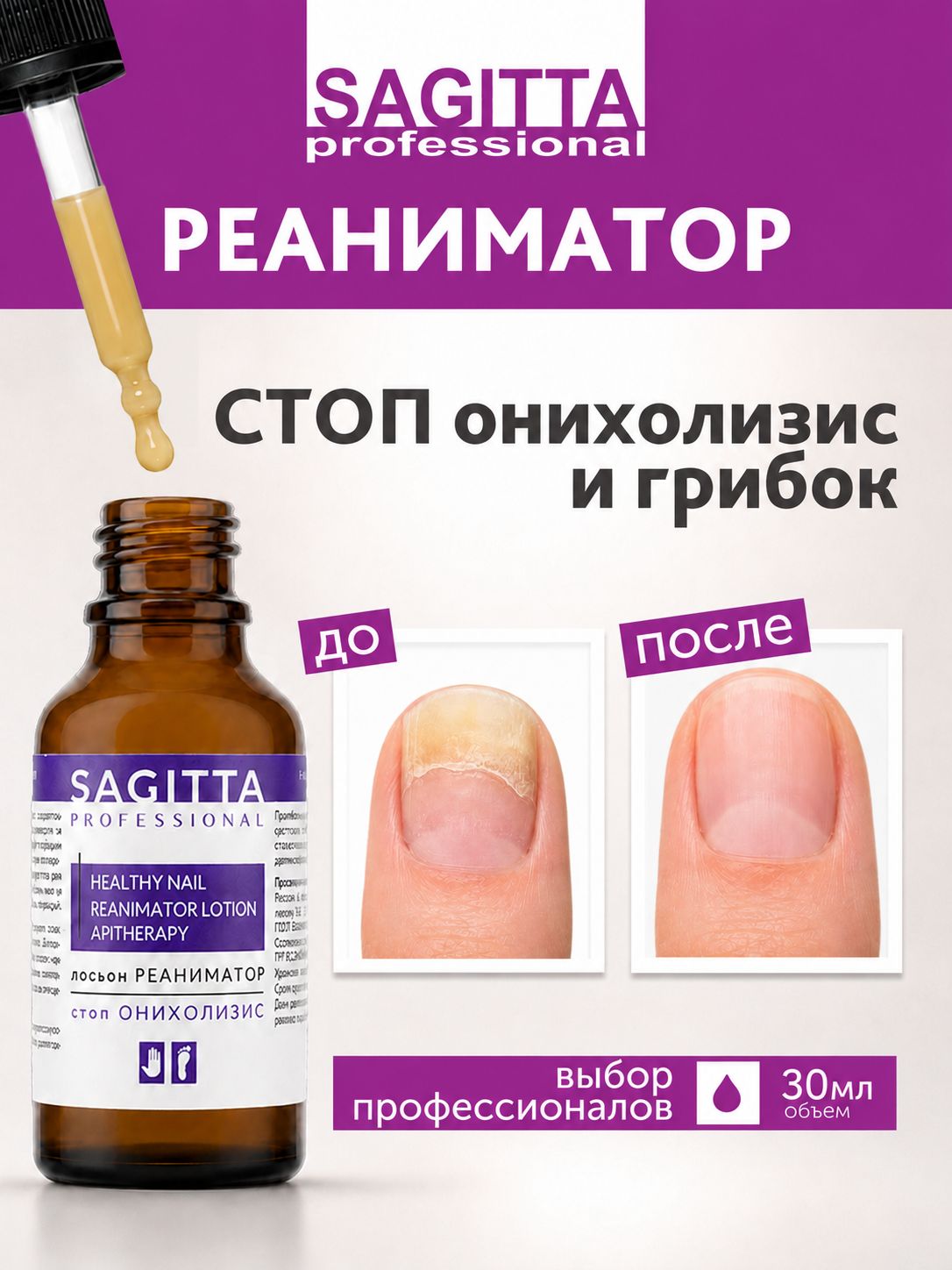 Средство от онихолизиса и грибка ногтей, лосьон реаниматор 30 мл