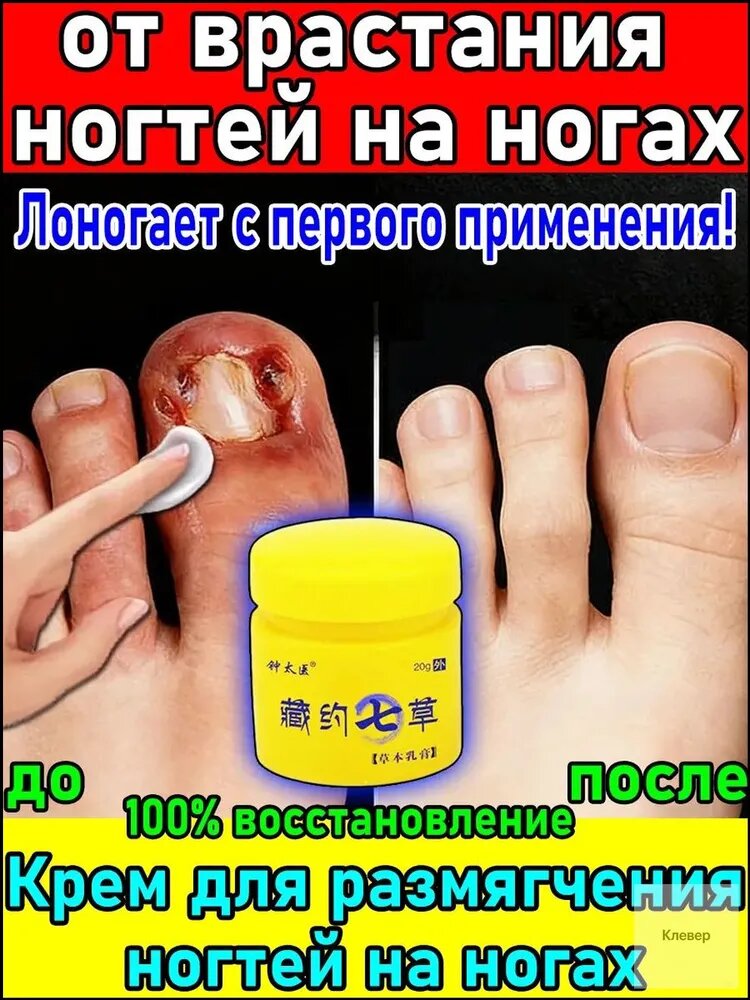 Китайский крем-мазь от вросших ногтей